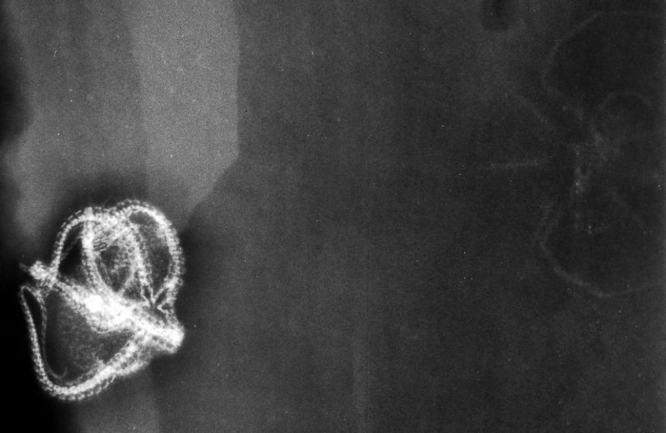 Bundenbach-Fossilien des Hunsrückschiefers im Röntgenlicht betrachtet